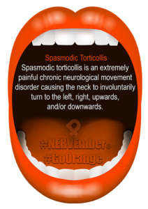 What Is Spasmodic Torticollis - iPain Foundation Condition Information