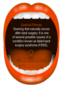 Epidural Fibrosis - iPain Foundation Condition Information